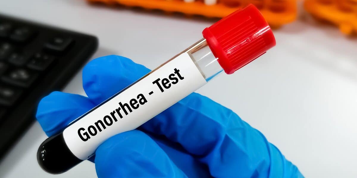 Gonorrhea Symptoms & Treatment: Rapid STD Testing Guide